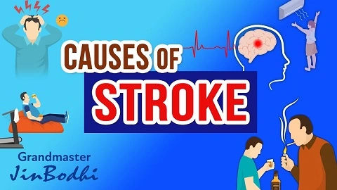 Causes of Stroke - Grandmaster JinBodhi